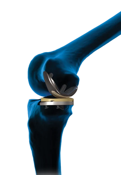 Weekly Implant | Tools & Resources